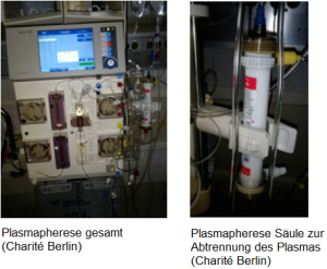 Plasmapherese Immunadsorption – Stiff-Person Vereinigung Deutschland e.V.